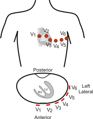 Medicine Decoded: Ecg leads